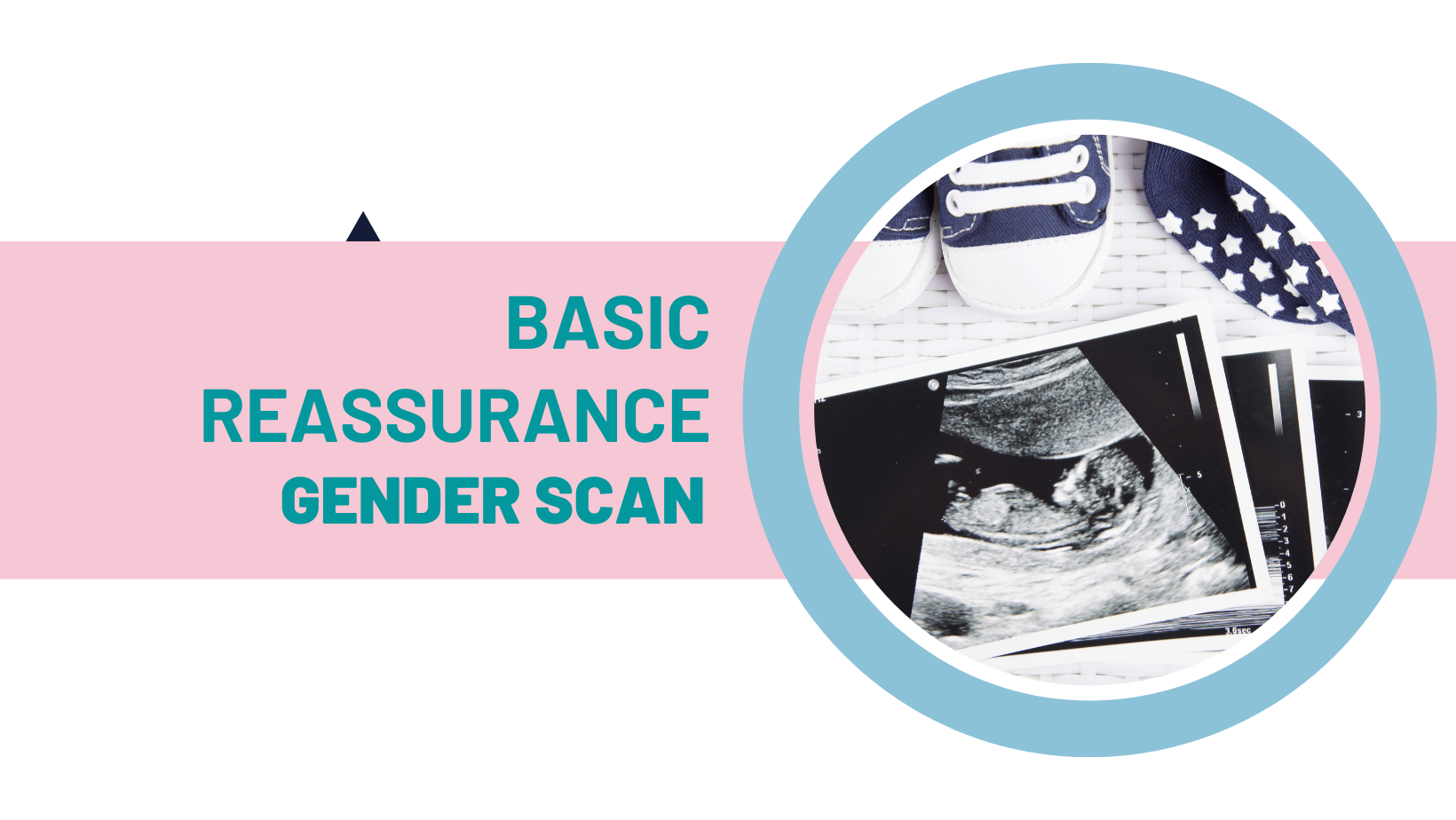 2D/3D/4D Baby Scan Centre | Baby Scan UK | Gender Scans