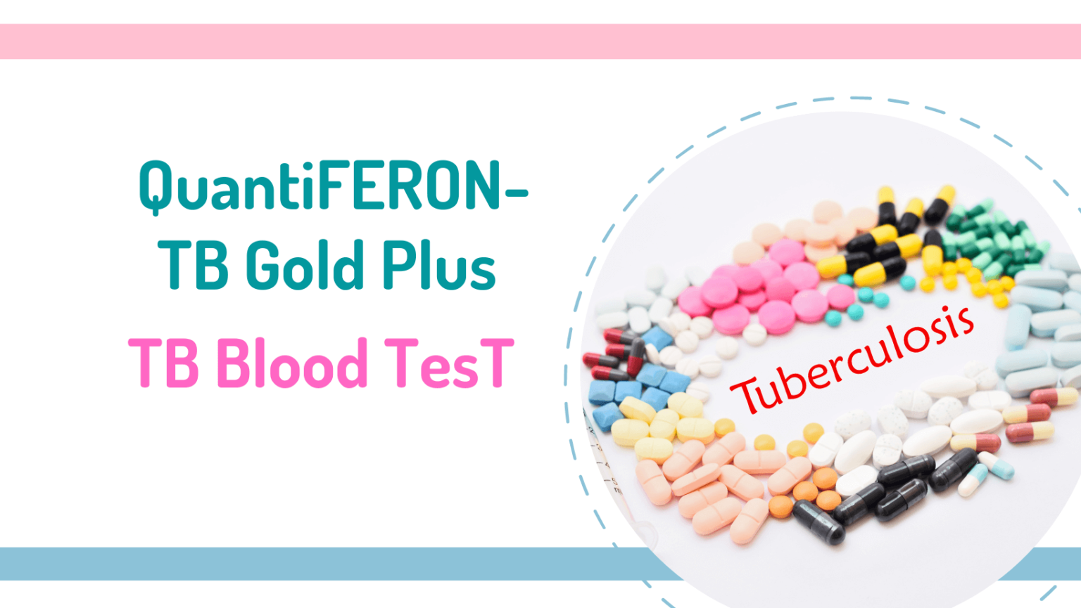 Tuberculosis Blood Test QuantiFERON TB Gold Plus – Miracle Inside