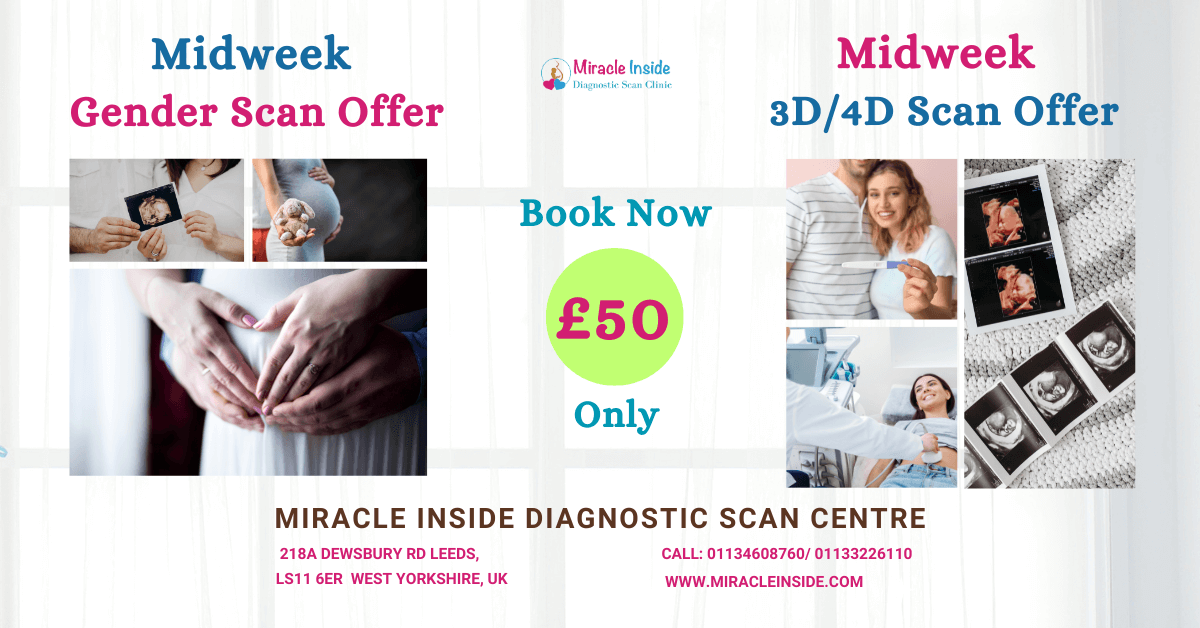 2D/3D/4D Baby Scan Centre | Baby Scan UK | Gender Scans