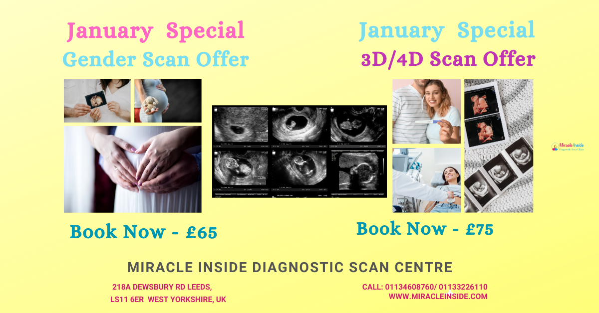2D/3D/4D Baby Scan Centre | Baby Scan UK | Gender Scans